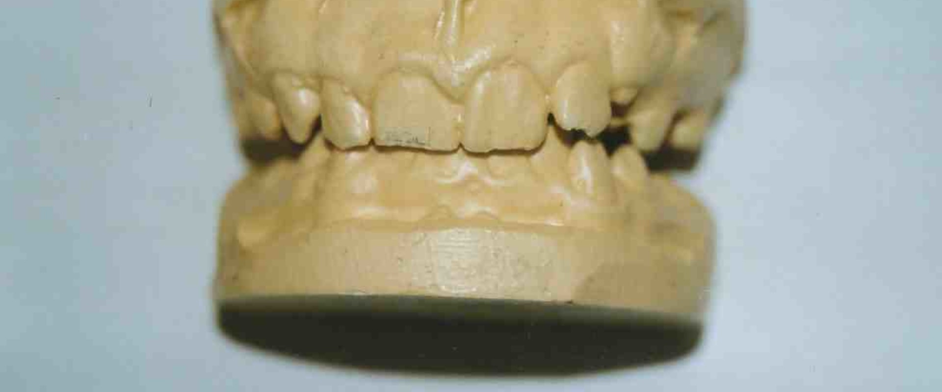 Unveiling the Secrets of Forensic Odontology